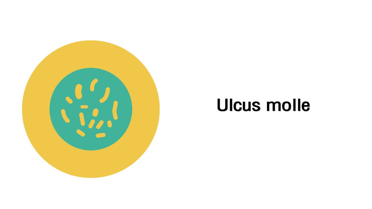 Ulcus molle (Weicher Schanker) - Infektionskrankheiten - YouTube