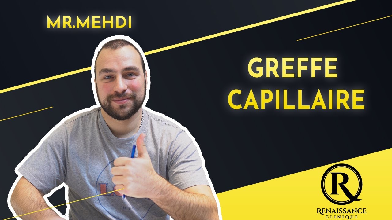 Témoignage Patient (Mr.Mehdi) / Implants Capillaires / Renaissance ...