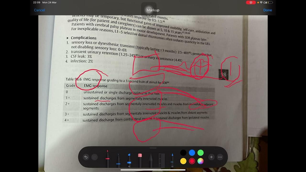 1sec train of stimuli - YouTube