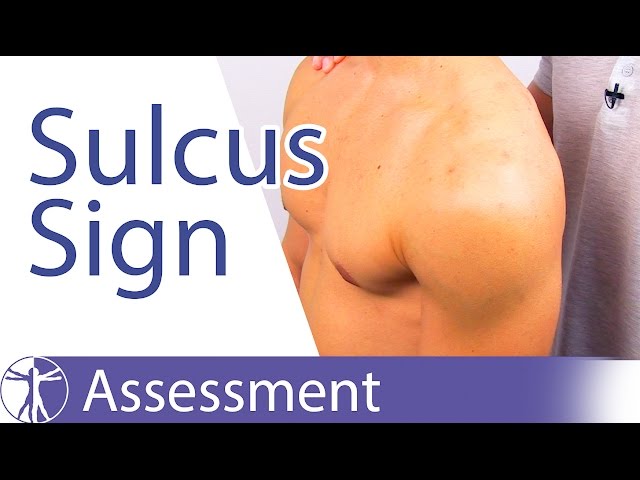 Sulcus Sign ⎟ Shoulder Instability