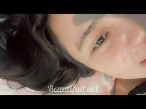 Bigo live 🍓Open VCS