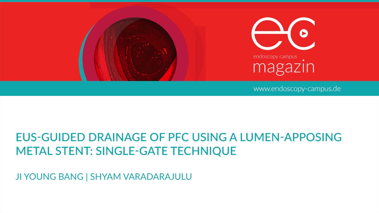 EUS Guided drainage of PFC - YouTube