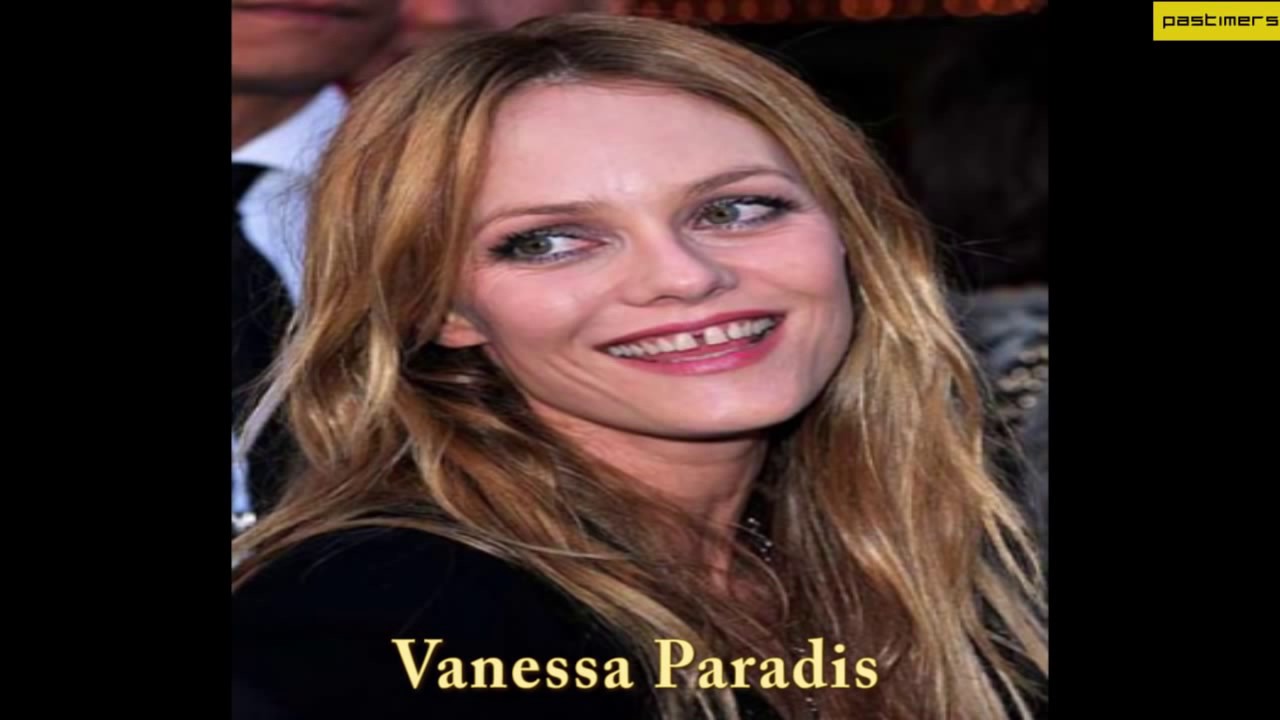 The Unseen Photos of Celebrities With Physical Defects || Pastimers ...