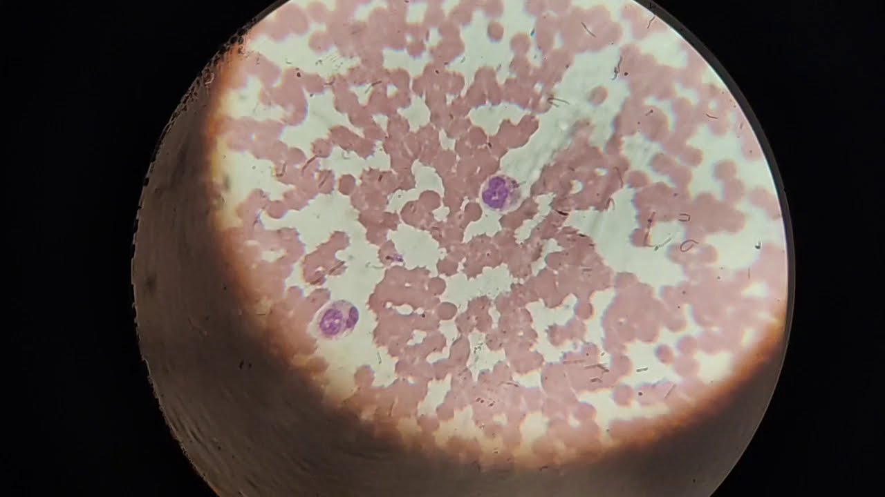 Práctica: Tinción Wright - YouTube