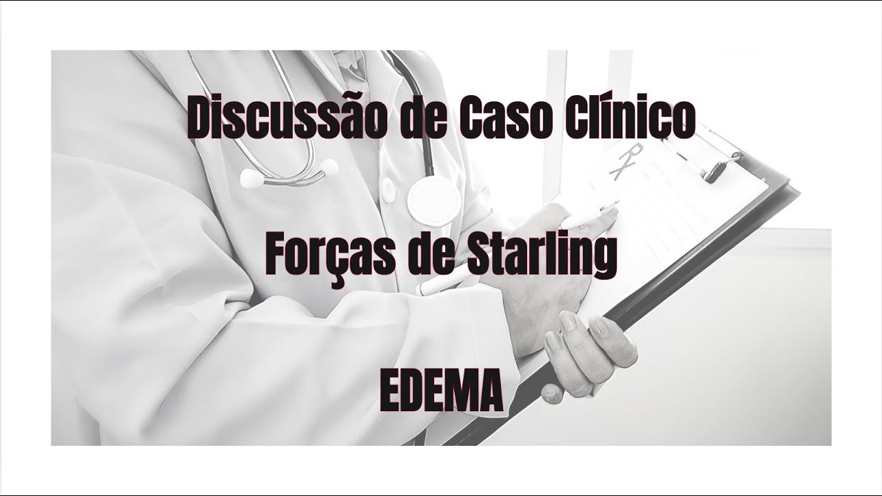 Discussão de casos clínicos - Forças de Starling - EDEMA / MinutoMed9 ...