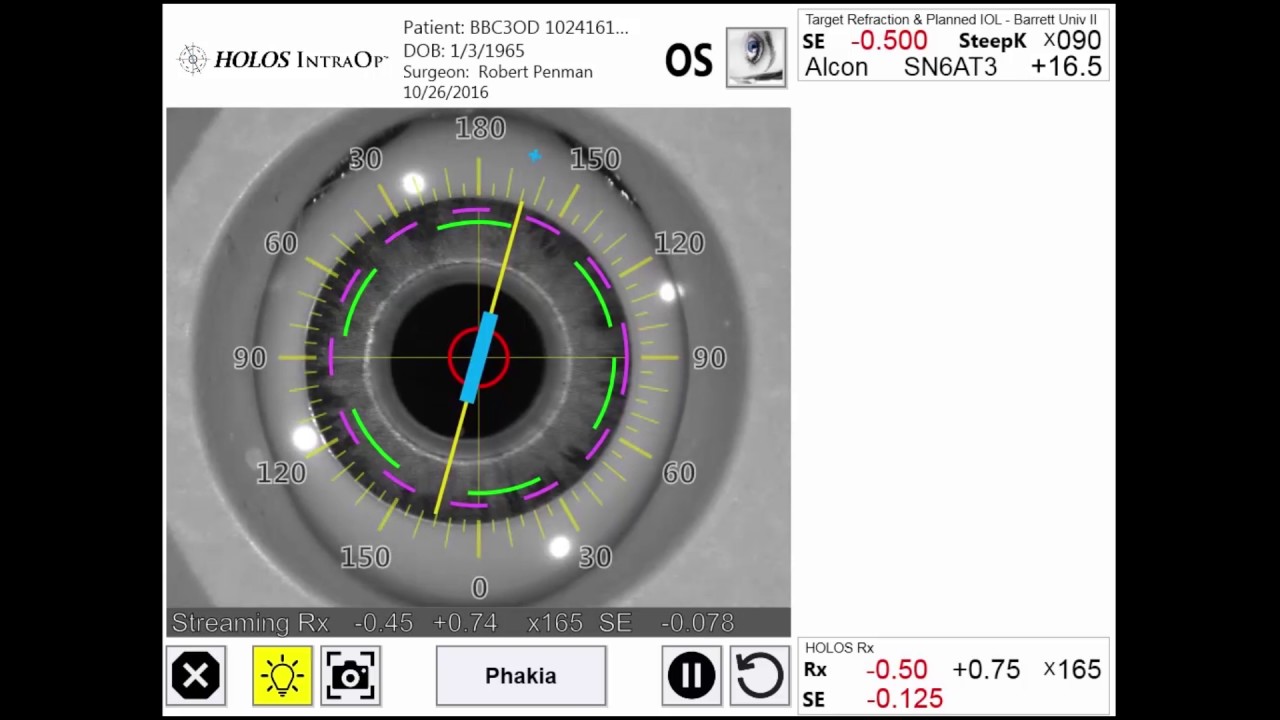 Upgrades to wavefront aberrometer enhance surgical feedback - YouTube