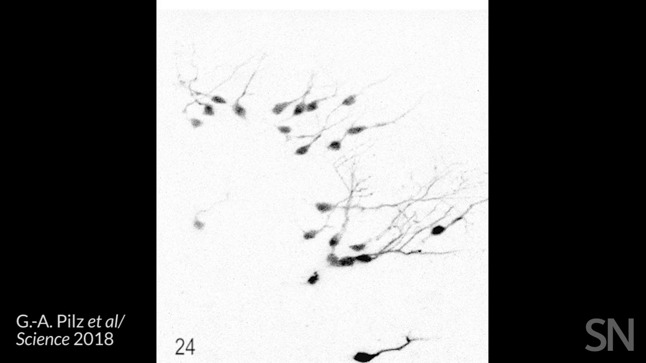 Watch nerve cells form in a mouse brain | Science News - YouTube