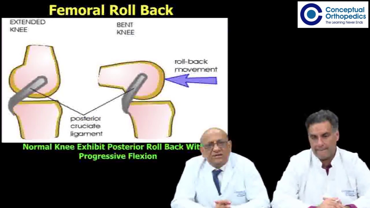 Pearls of Total Knee Replacement - Dr Shekhar Agarwal - The wise man of ...