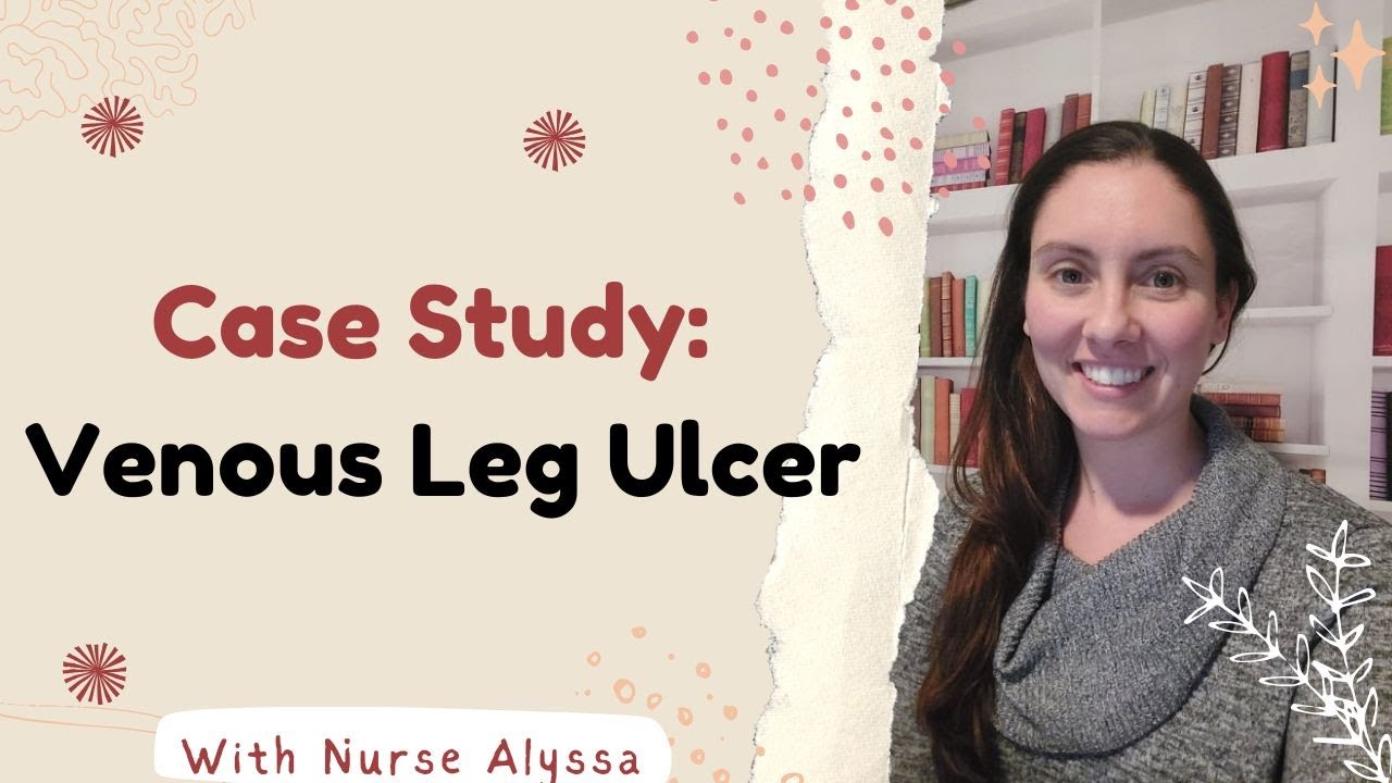 Venous Leg Ulcers: In-Depth Case Study & Treatment Strategies - YouTube