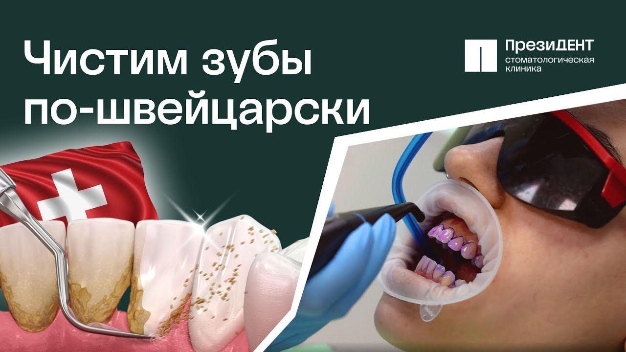 🤩 GBT protocol в стоматологии - что это? Как проходит процедура? В чем ...