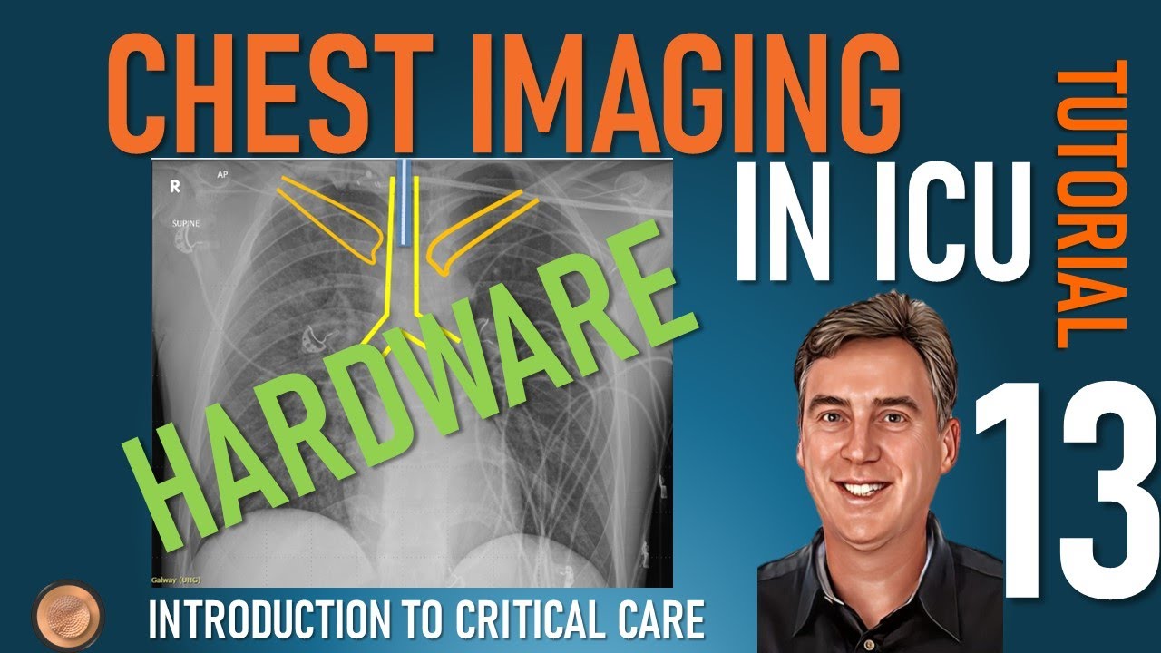 Chest Imaging in ICU - Part 2 - Hardware - YouTube