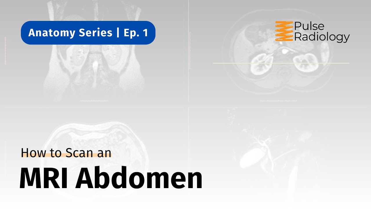 How to Scan an MRI Abdomen - YouTube