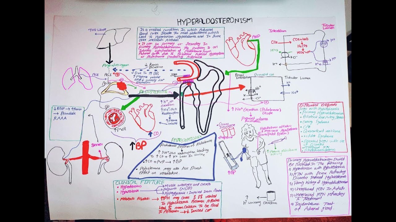 Hyperaldosteronism part1(Definition,Pathophysiology,Causes,Clinical ...
