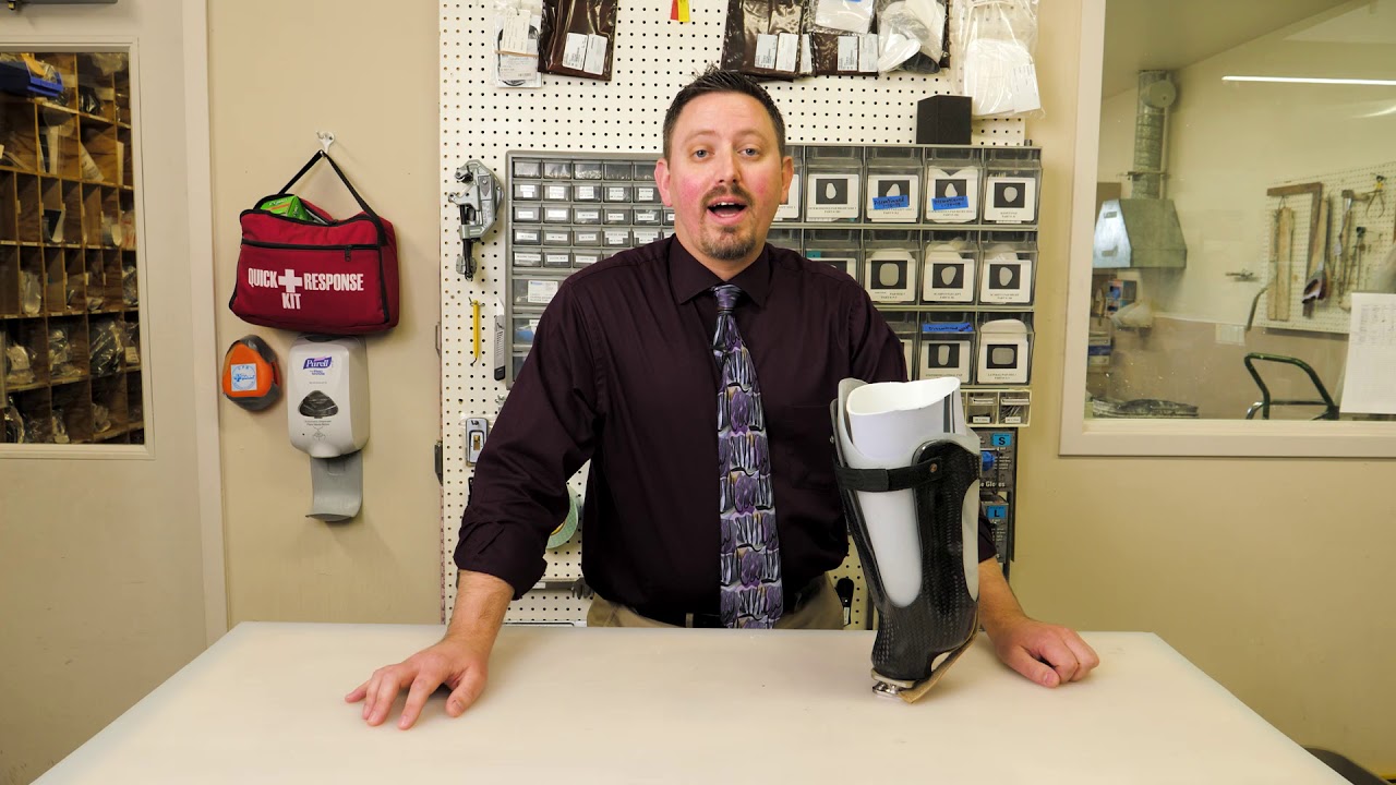 Hi-Fi Socket for Above Knee Amputees - YouTube