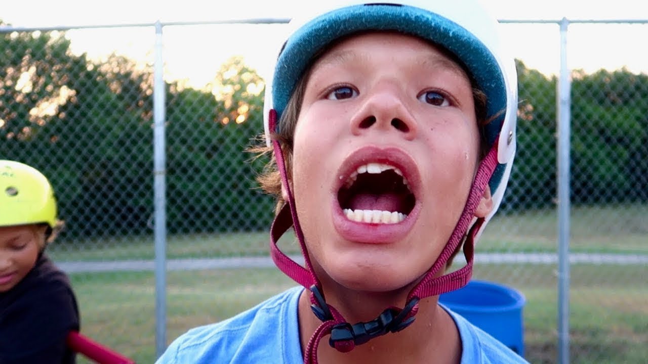 Kid Breaks His Tooth Trying My BMX Bike - YouTube