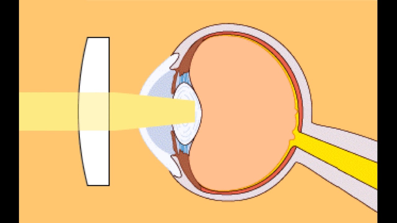 RS Vision Pathway Part 2 - OpticalSegment - YouTube