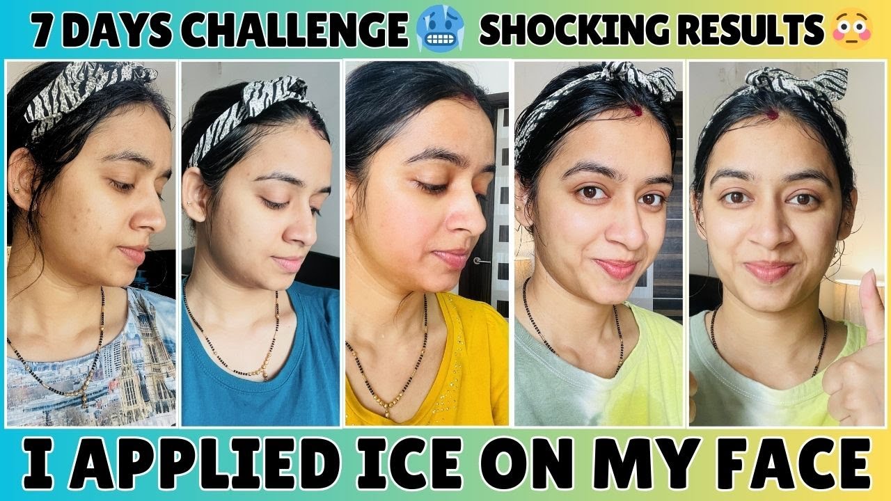 7 Days Challenge 🔥 I Applied ICE on my Face & This Happened #challenge ...