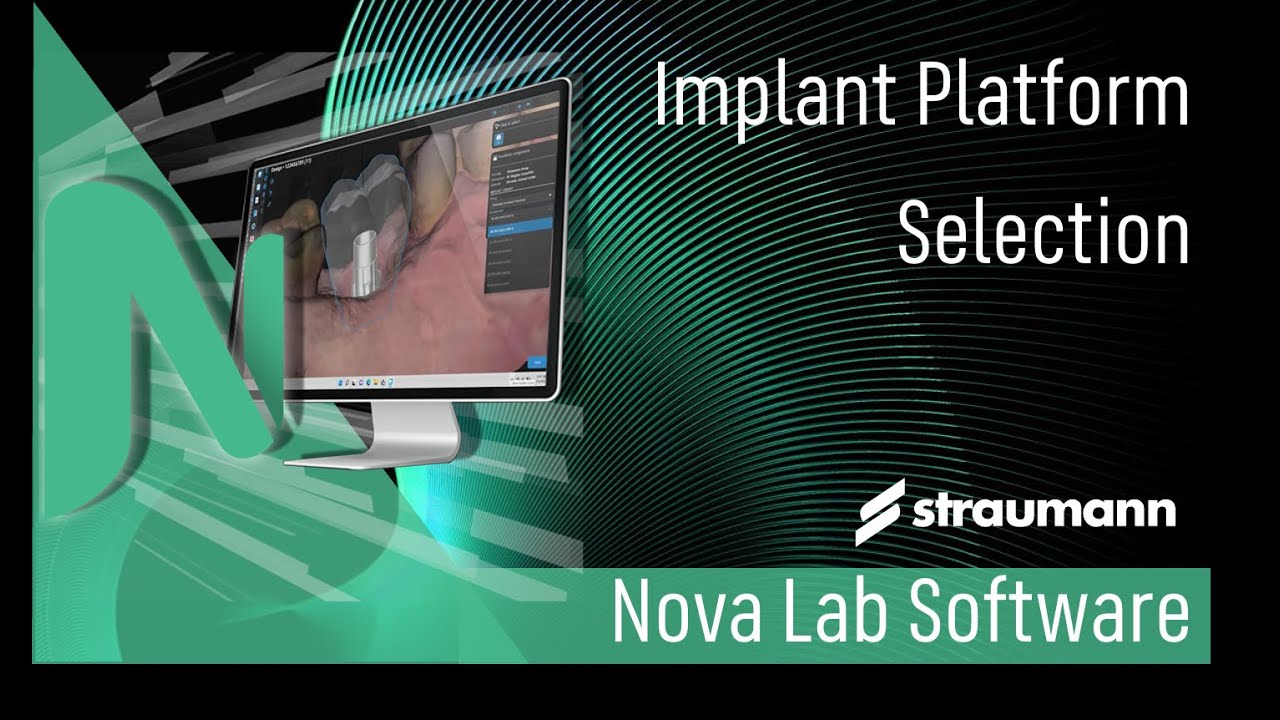 Implant Platform Selection with Straumann Design Lab Software - YouTube