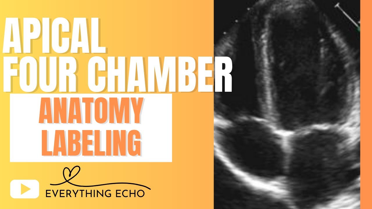 Apical Four Chamber- Anatomy Labeling - YouTube