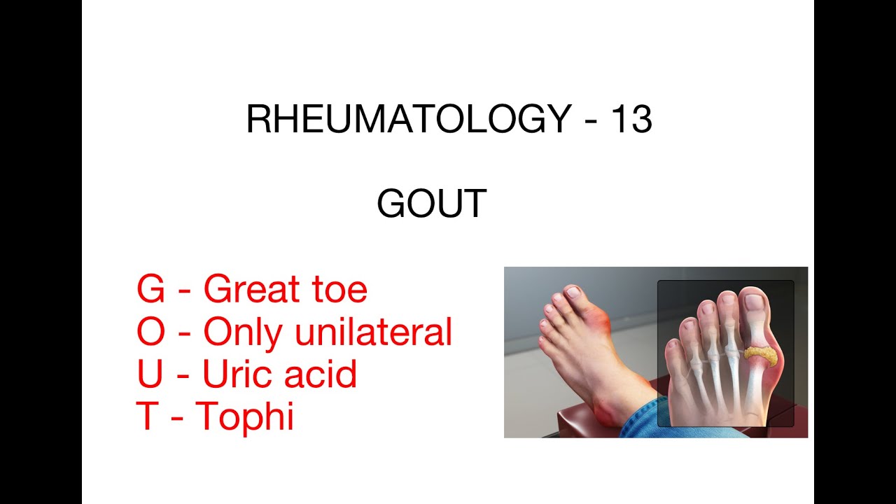 GOUT - PLAB/PLABABLE GEMS/PLABKEYS - PLAB/USMLE/FMGE/NEETPG ...