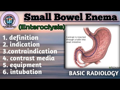SMALL BOWEL ENEMA PROCEDURE // ENTEROCLYSIS PROCEDURE // BASIC ...