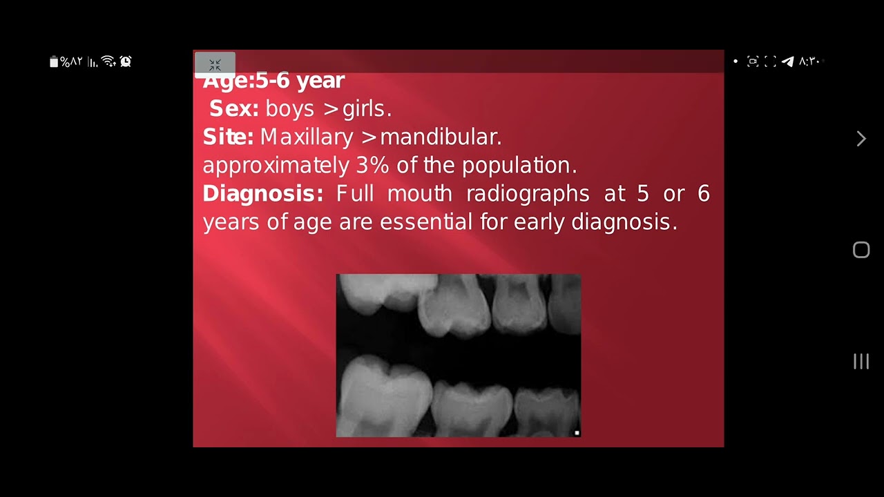 3rd community ( PREVENTION OF OCCLUSAL ABNORMALITIES 2) and (oral ...