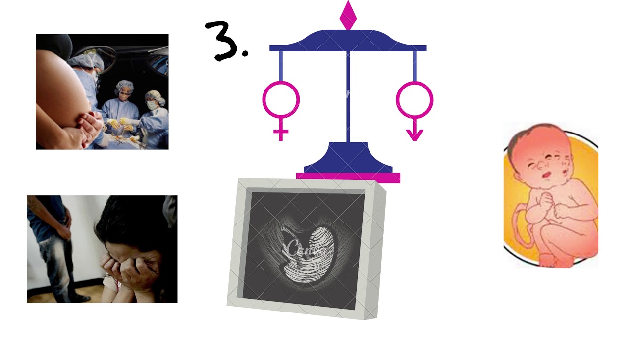 EL NASCITURUS,PERSONA Y PERSONALIDAD JURÍDICA. - YouTube