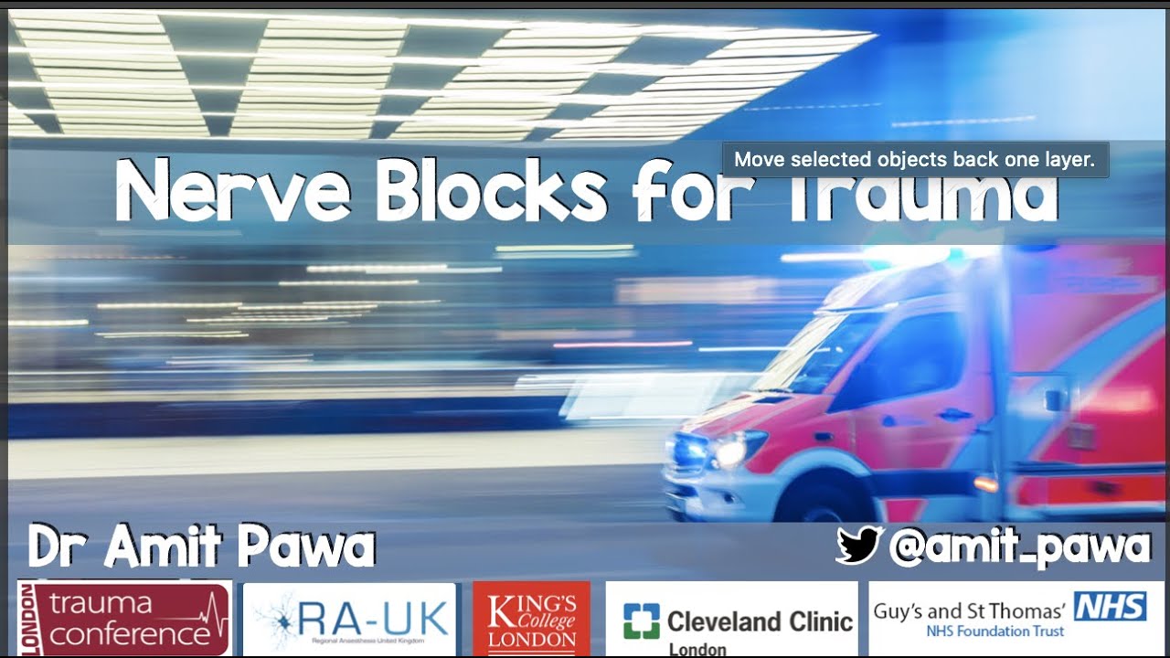 Nerve Blocks for Trauma - London Trauma Conference 2022 version - YouTube