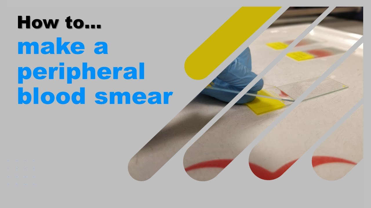 How to make a peripheral blood smear - YouTube