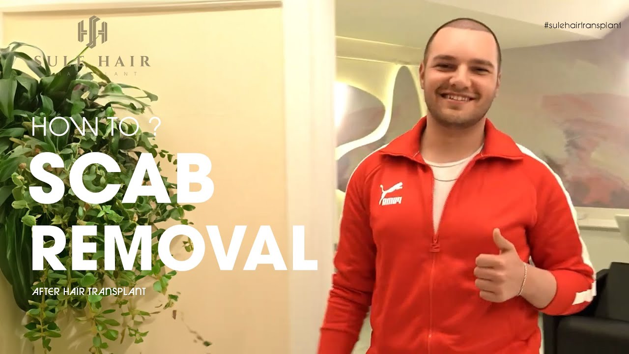 Post-Hair Transplant Care: Mastering Scab Removal for Healthy Growth ...