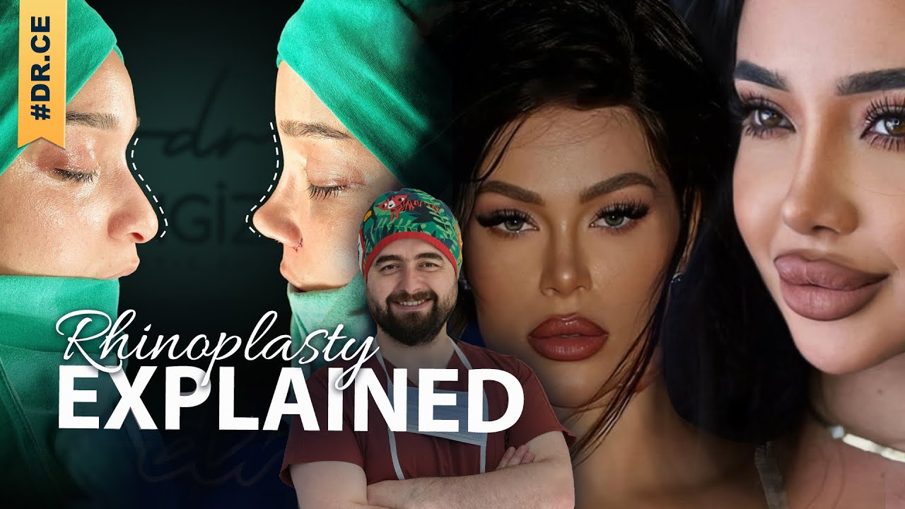 Rhinoplasty (Nose Job) – ALL EXPLAINED! | Q&A with Dr. Cengizhan 👀 ...