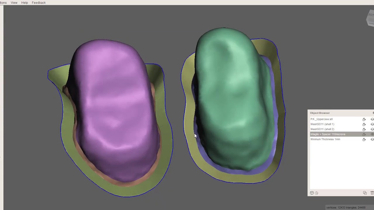Meshmixer - Advanced Crown Design (Emergence Profile Technique) - YouTube