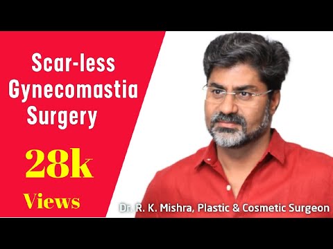 An Innovative Scar-less Approach in Gynecomastia Surgery - YouTube