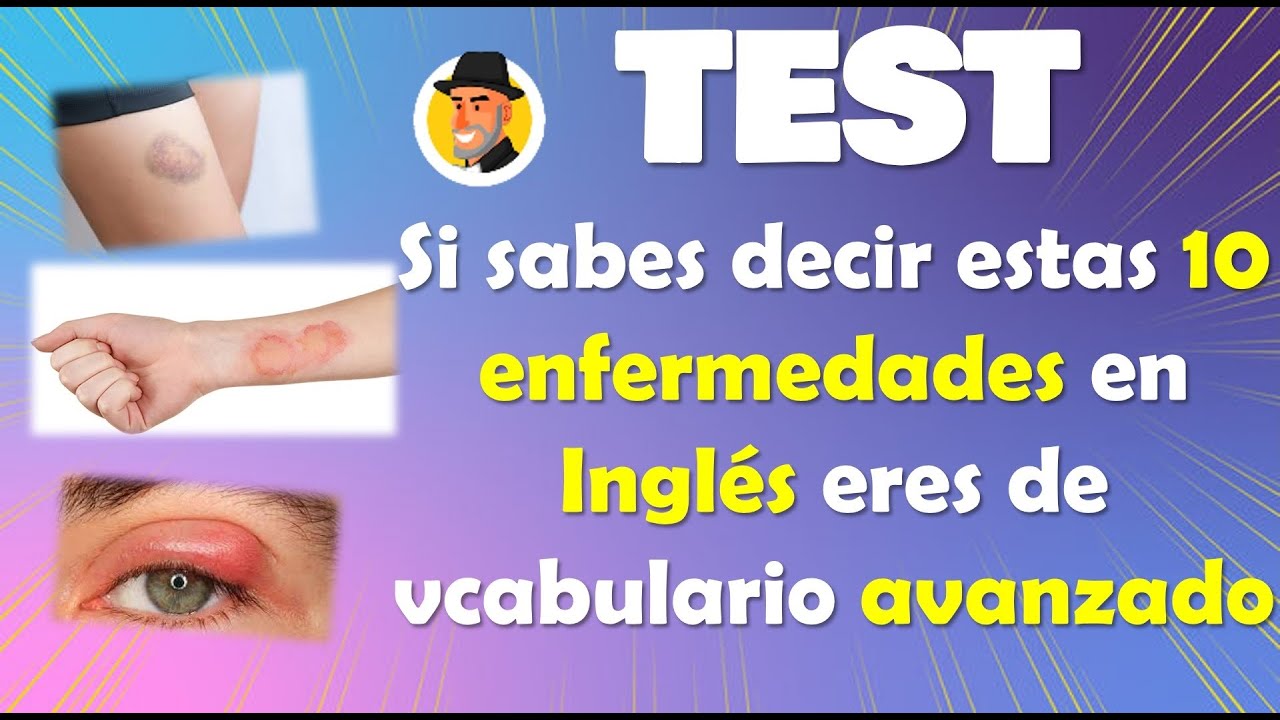 Si sabes decir estas 10 enfermedades en Inglés eres de vocabulario ...