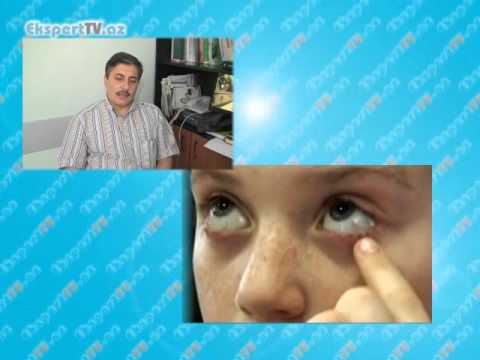 Su çiçəyinin əlamətləri nələrdir?  (2)