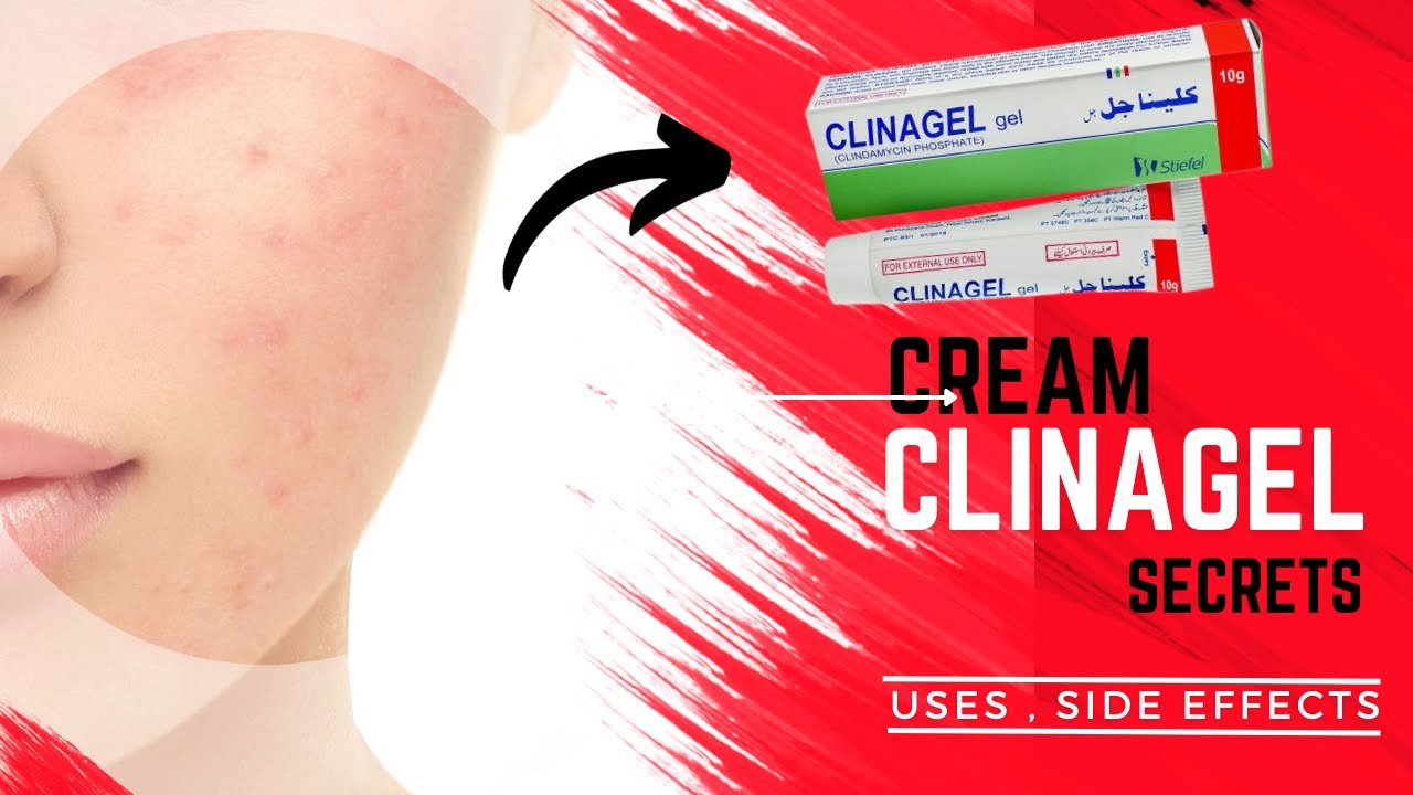 Clinagel (gel) review in urdu || clinagel gel review || clinagel cream ...