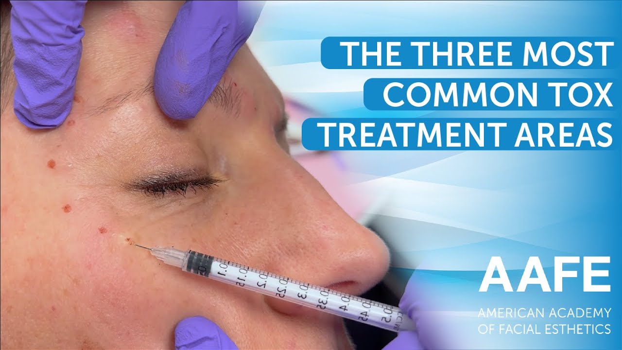 The Three Most Common Tox Treatment Areas - YouTube
