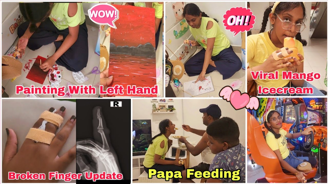 Star Broken Finger Injury Update😰New X-RAY/Healing😊Painting With Left ...