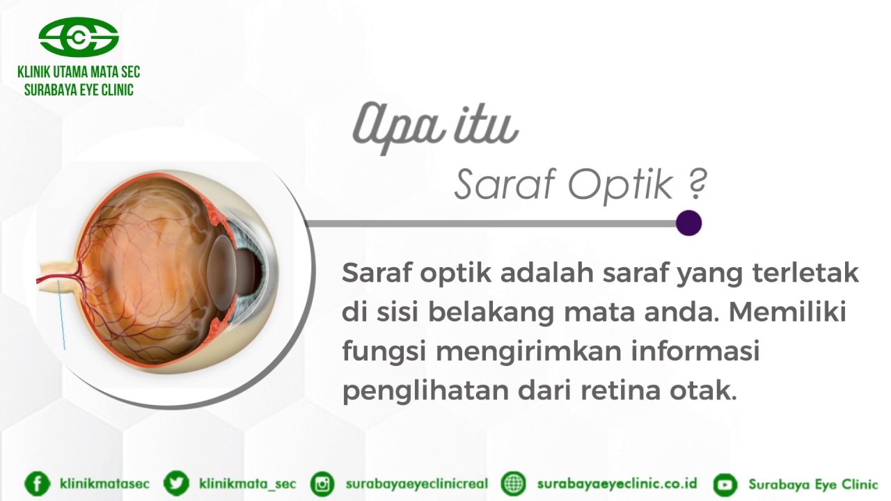 Inilah yang dimaksud dengan Saraf Optik -Surabaya eye clinic - YouTube