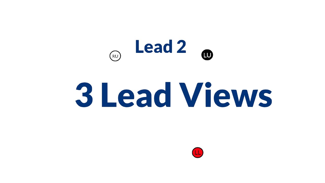 Lead 2 from a 3 Lead ECG - YouTube