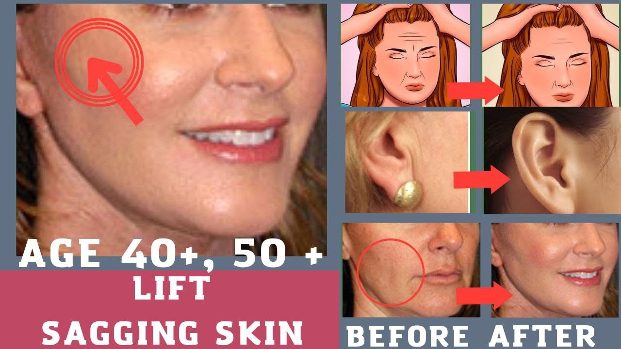 Age 40+, 50+| Lift Sagging Skin |Nasolabial Folds| Ears, Neck and Head ...