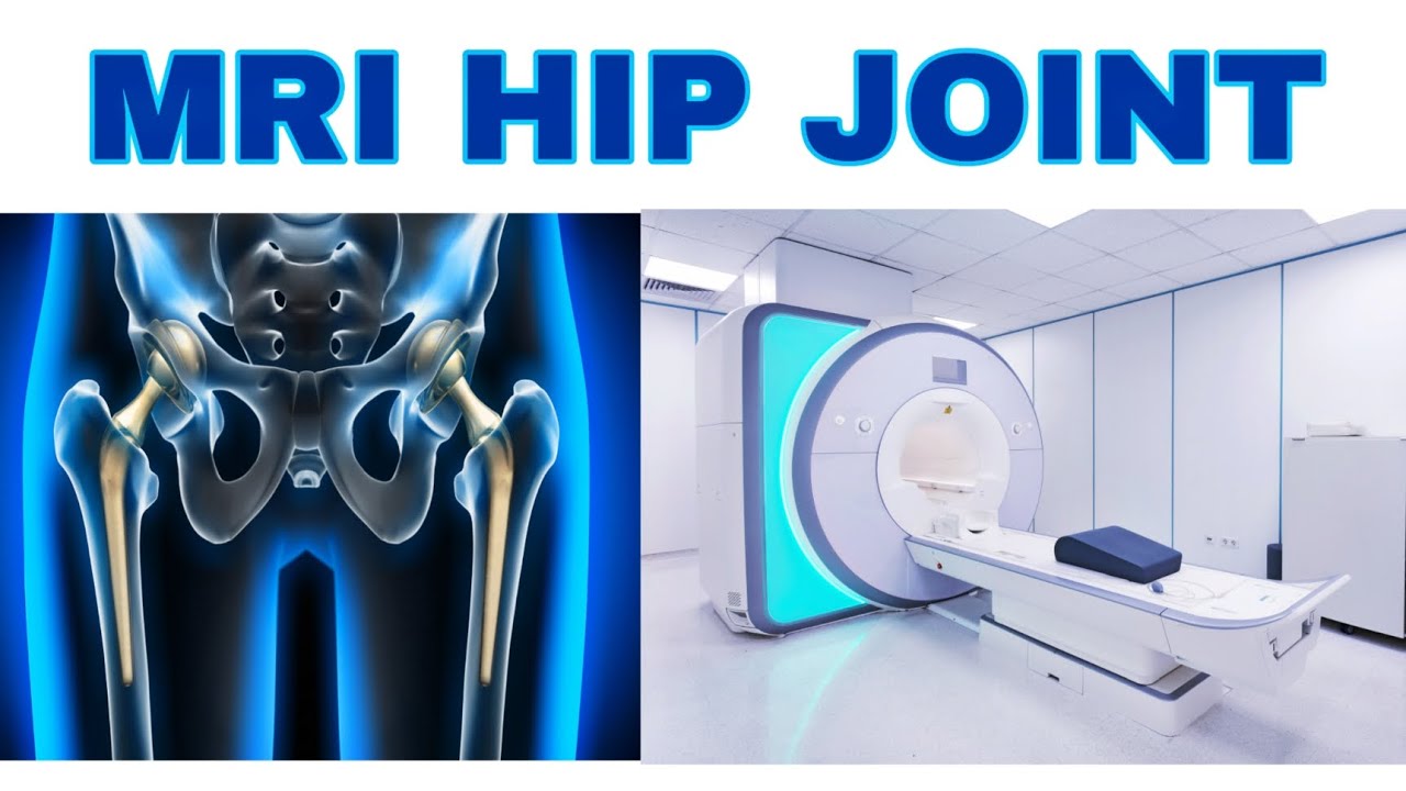 MRI HIP JOINT, MRI SCAN - YouTube