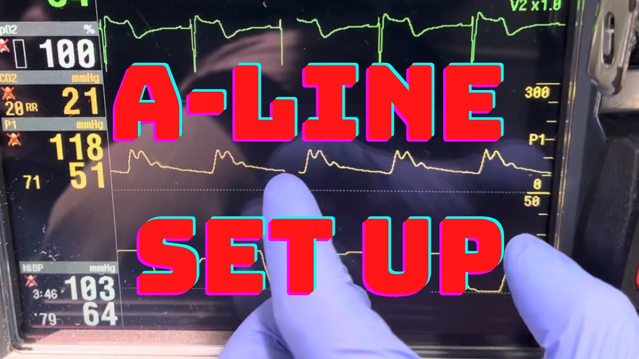 How to Set Up Pressure Transducer for an A-Line with LifePak 15? - YouTube