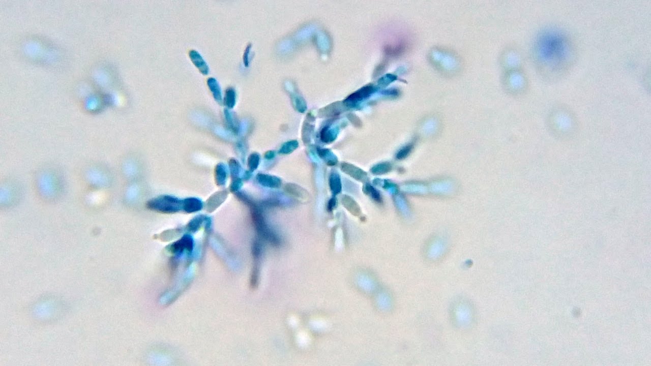 Pseudomycelium in Yeasts , order Saccharomycetales - YouTube