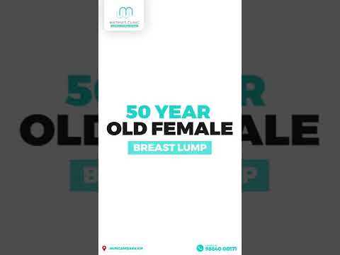 50 Year Old Female had Breast Lump | How we cured it ?