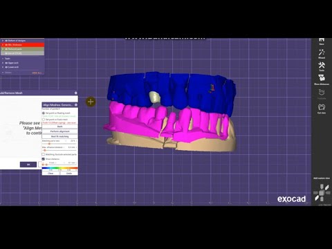 EXOCAD Bite Alignment Scan - YouTube