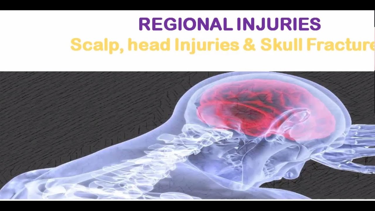 Regional Injuries Part 1 | Head Injuries | Forensic Medicine Lecture ...