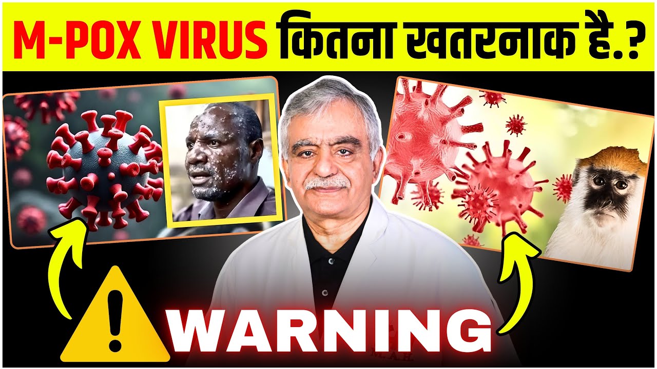 M-POX Virus Explained: How Dangerous Is It Really? | Dr Devindra Sehra ...