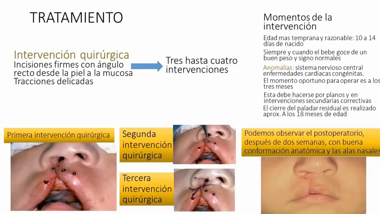 PATOLOGIAS DEL RECIEN NACIDO malformaciones congénitas - YouTube