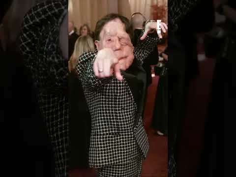 Adam Pearson's #Glambot left us a different man! #Oscars2026 #DisabilityPride